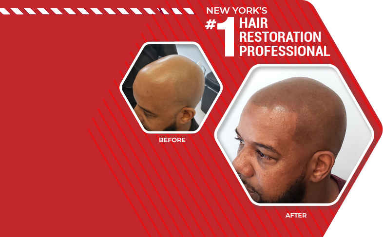 Does Potassium Help With Hair Loss 6917