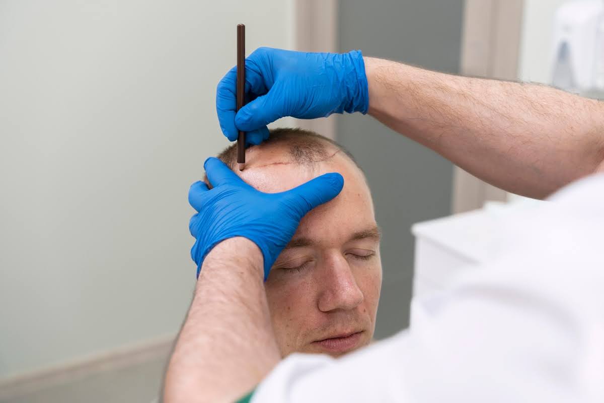 Scalp Micropigmentation Colors: How to Find Your Perfect Match